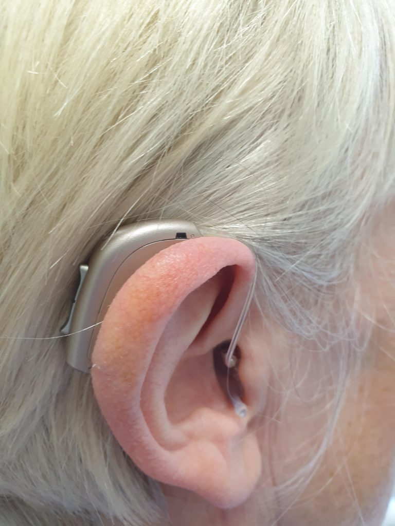 Audiology - South Eastern Health & Social Care Trust